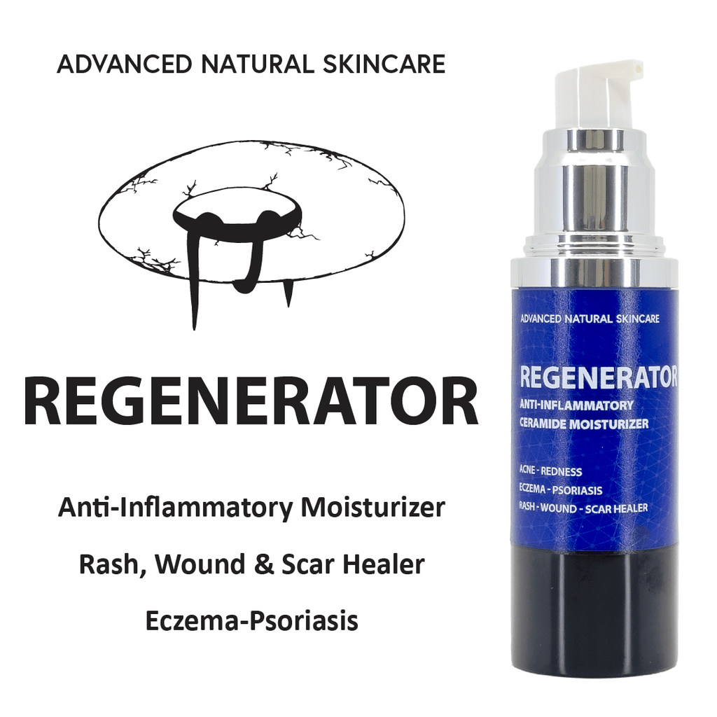 REGENERATOR CREAM - Anti-Inflammatory, Wound & Scar Healer, Eczema, Ps ...